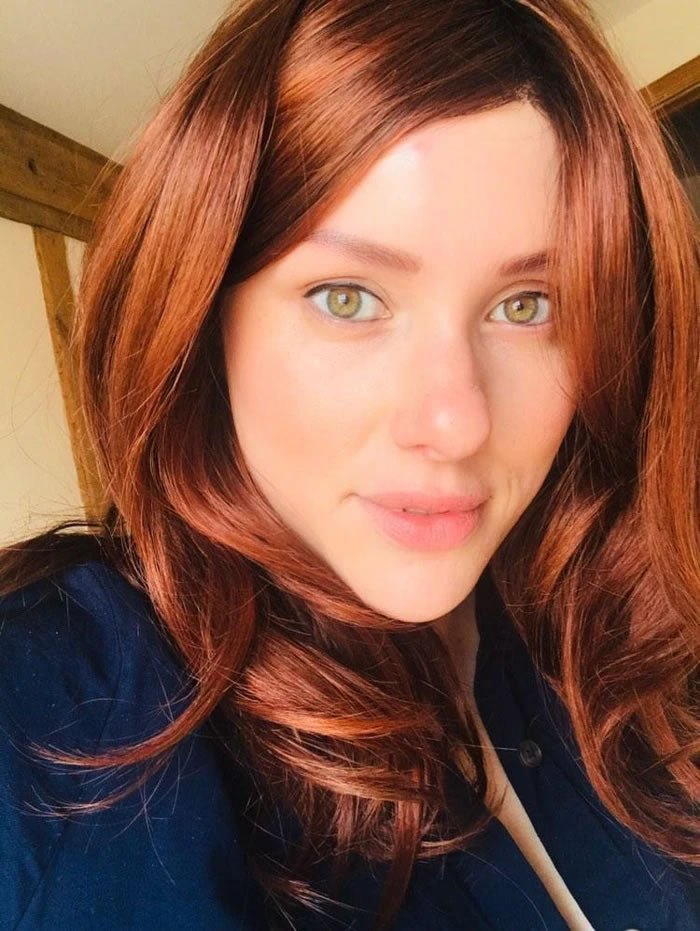 Introducing Laura's Story - Her Hair Loss From Age 13 – Valentine Wigs
